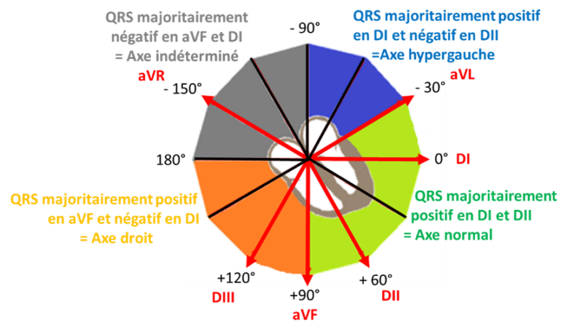 Comment lire un ECG ? | Spengler