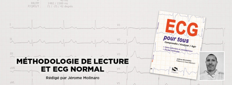 Comment lire un ECG ? | Spengler