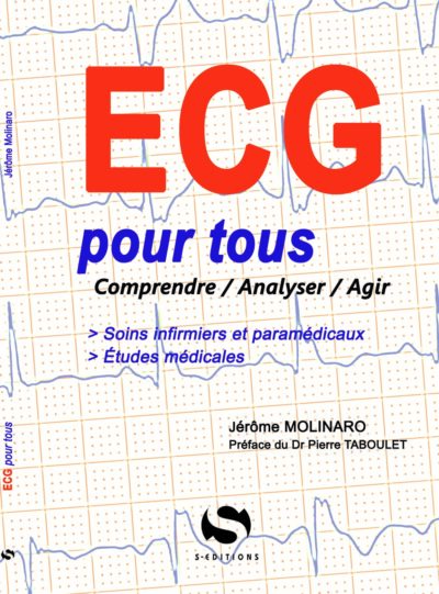 Comment lire un ECG ? | Spengler
