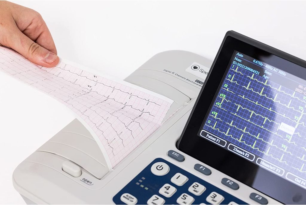 Comment positionner les électrodes ECG ? | Spengler