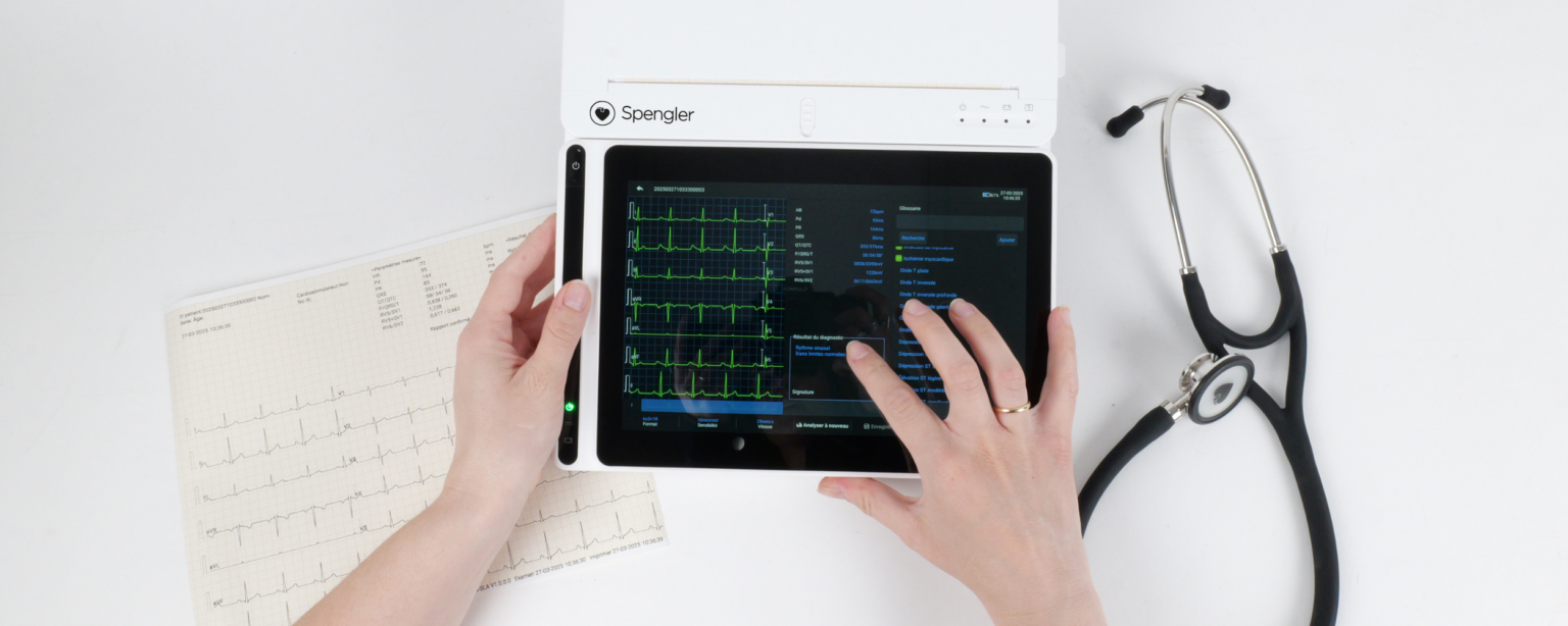 ECG 18 dérivations : la position des électrodes | Spengler