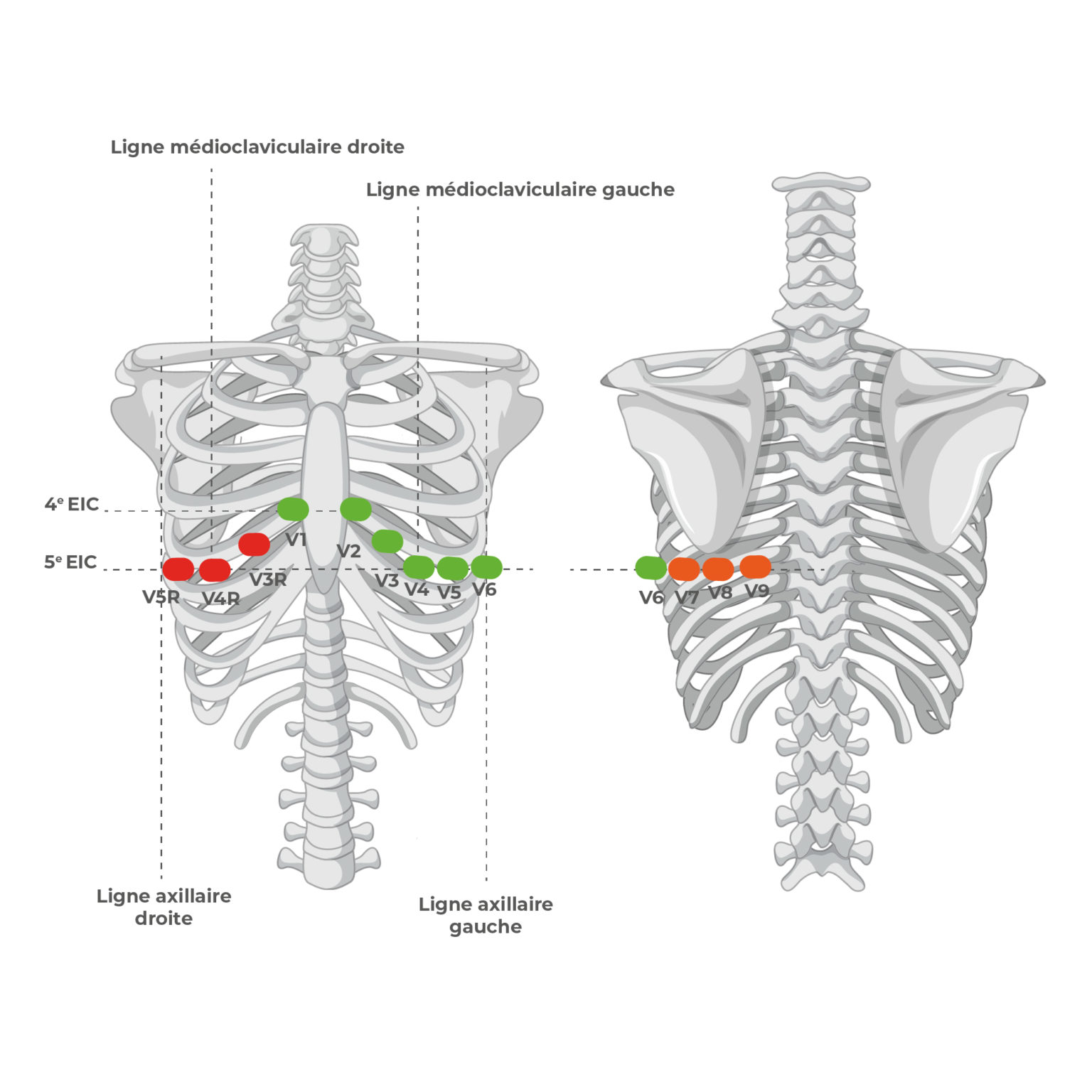 ECG 18 dérivations : la position des électrodes | Spengler